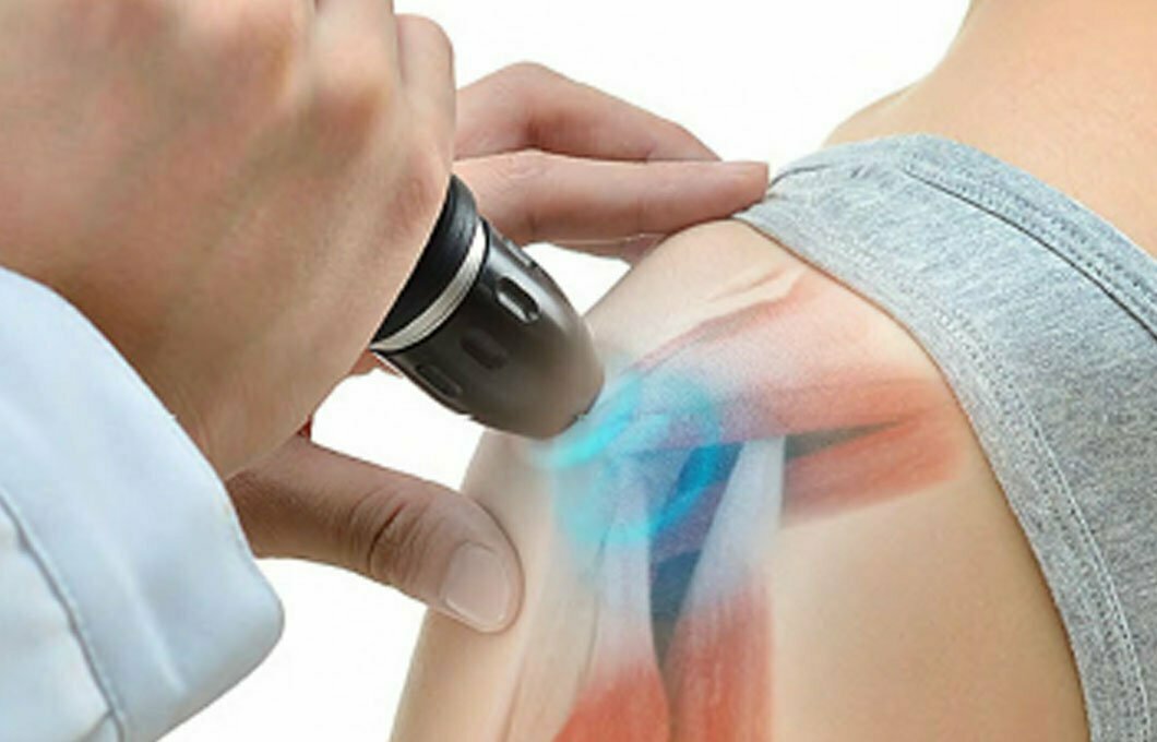 Shockwave Therapy - Sound Chiropractic